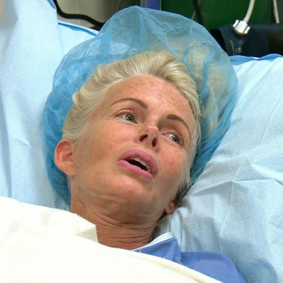 Will This Botched Patient Back Out Of Surgery Watch E Online Ca